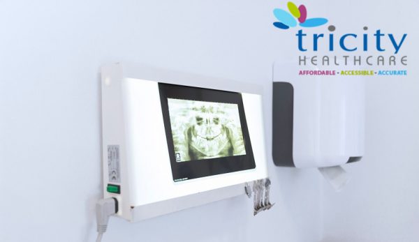 Patient Safety Tips while Opting Portable X-ray at Home - Tricity ...