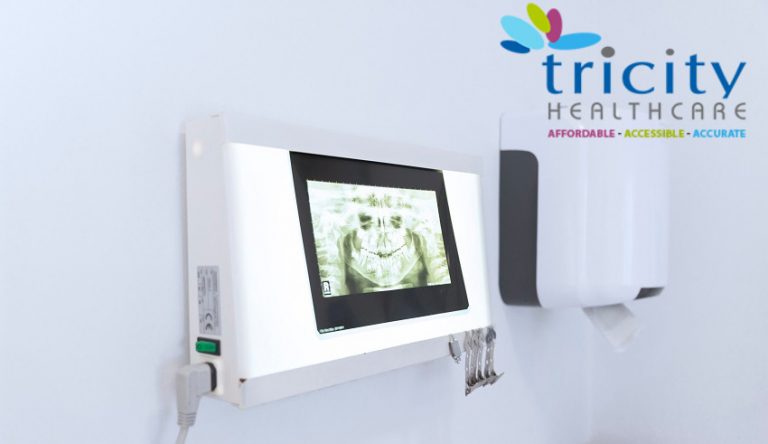 Patient Safety Tips while Opting Portable X-ray at Home - Tricity ...