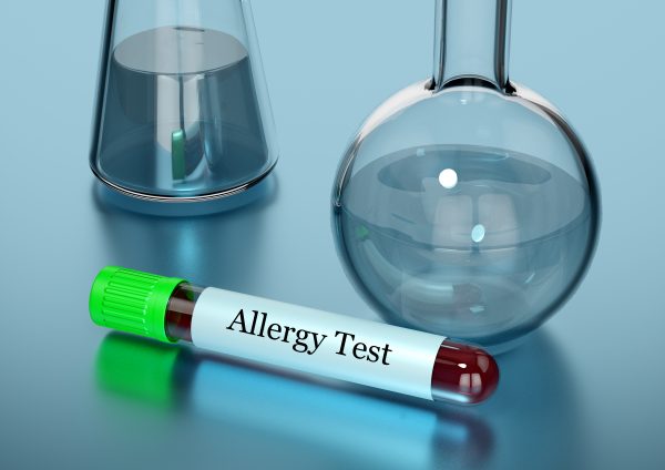 How Getting an Allergy Screening Test Can Save Your Life